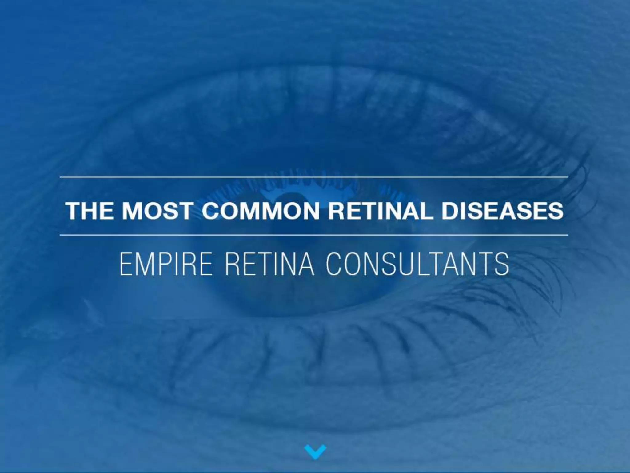 The Most Common Retinal Diseases | PPTX