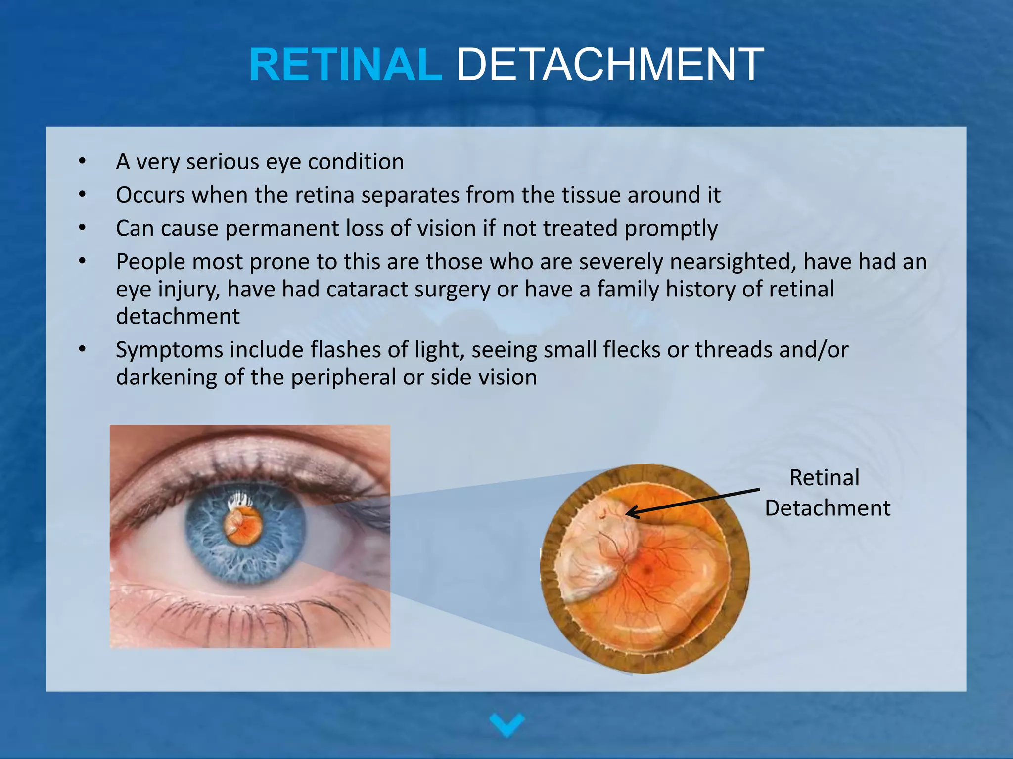 The Most Common Retinal Diseases | PPT | Free Download