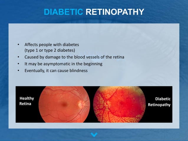 The Most Common Retinal Diseases | PPTX