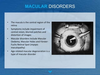 The Most Common Retinal Diseases | PPTX