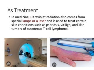 Acid Base Catalysis and ultraviolet u .v light | PPTX