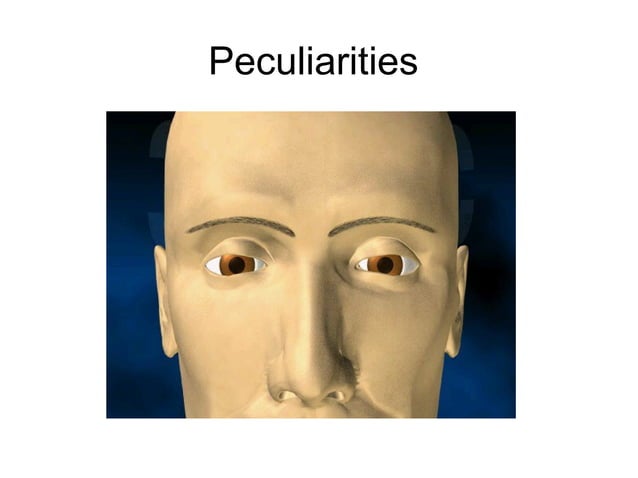 Pathophysiology of Graves Orbitopathy | PPT
