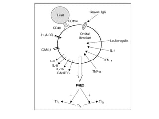 Pathophysiology of Graves Orbitopathy | PPT