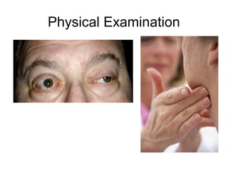 Pathophysiology of Graves Orbitopathy | PPT