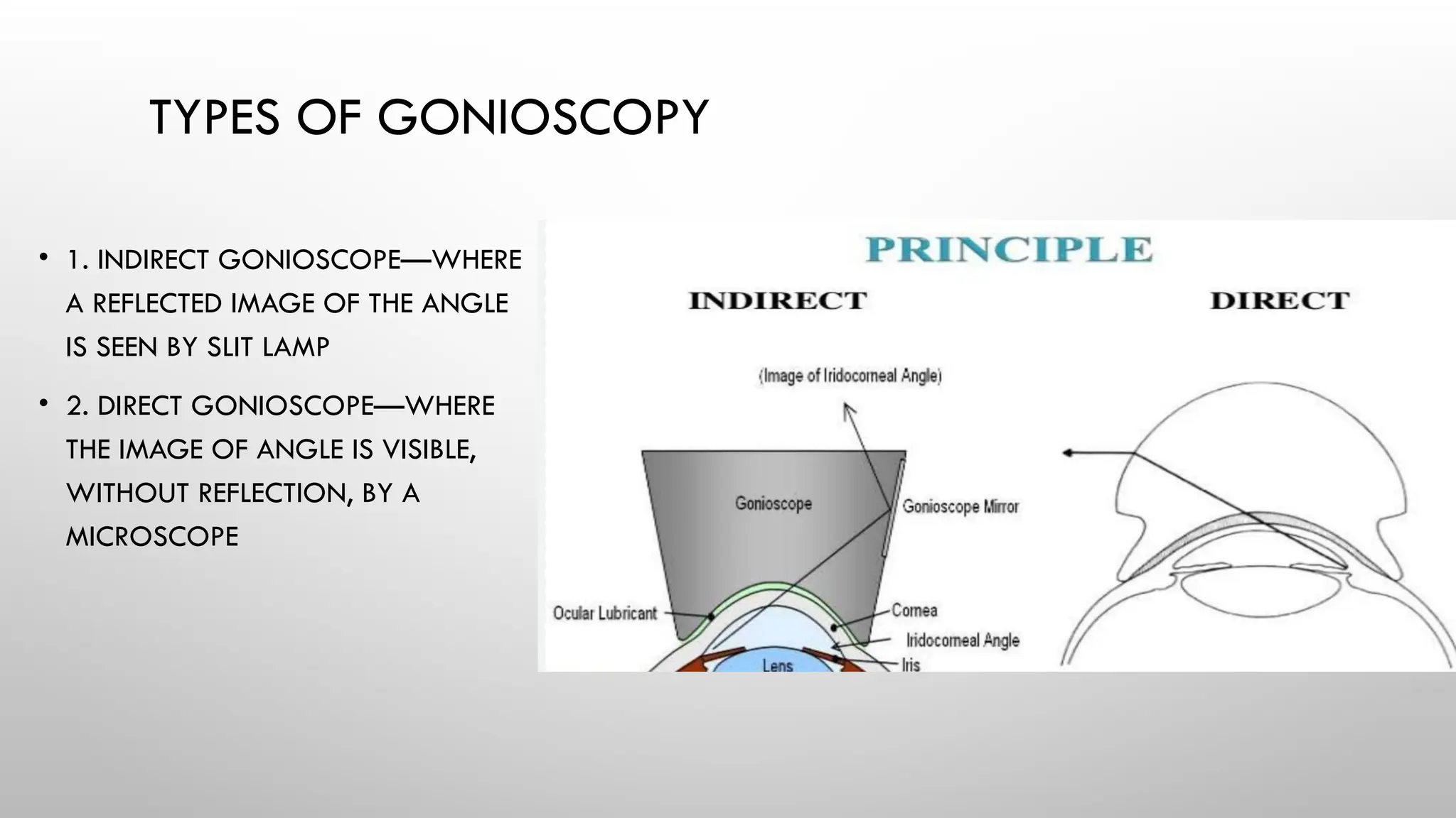 Tonometry and gonioscopy............pptx