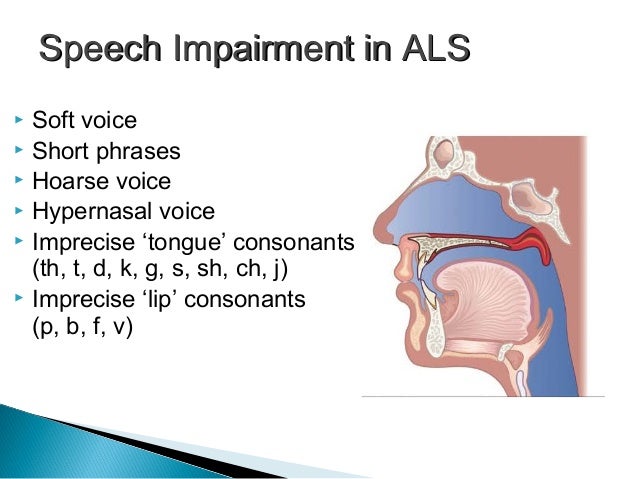 Presentation 213 jeannette hoit and cassandra faux speech management