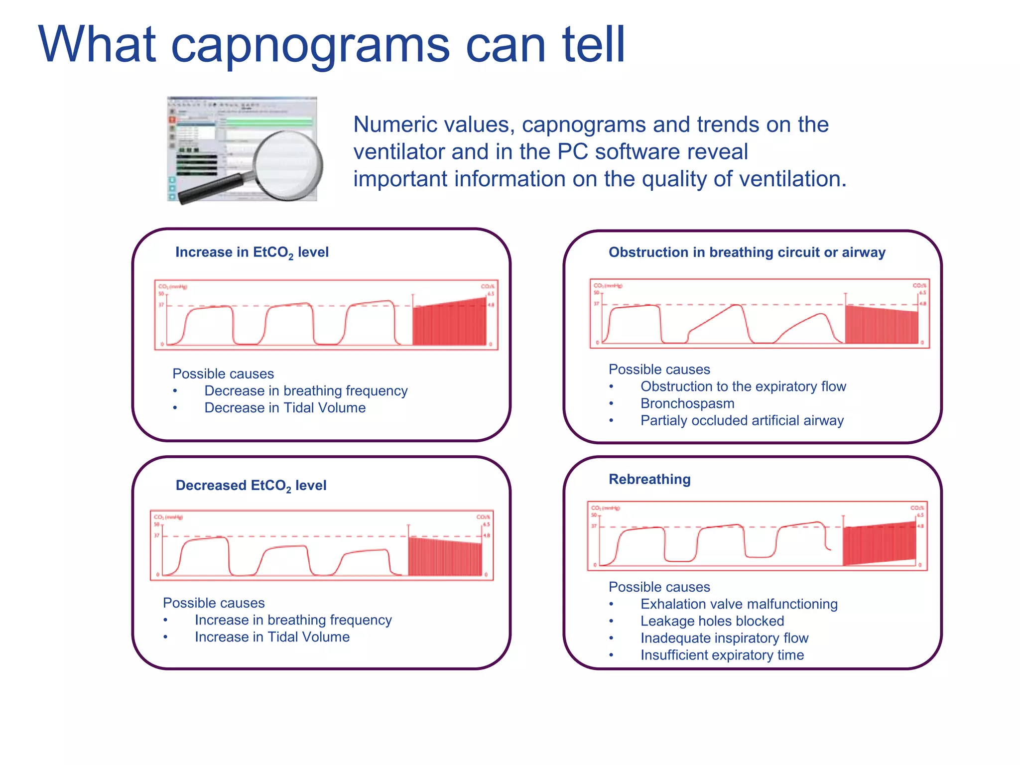 Presentation 215 a j_mark_barch_etco2 monitoring generic | PPTX