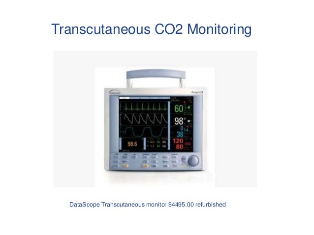 Presentation 215 a j_mark_barch_etco2 monitoring generic