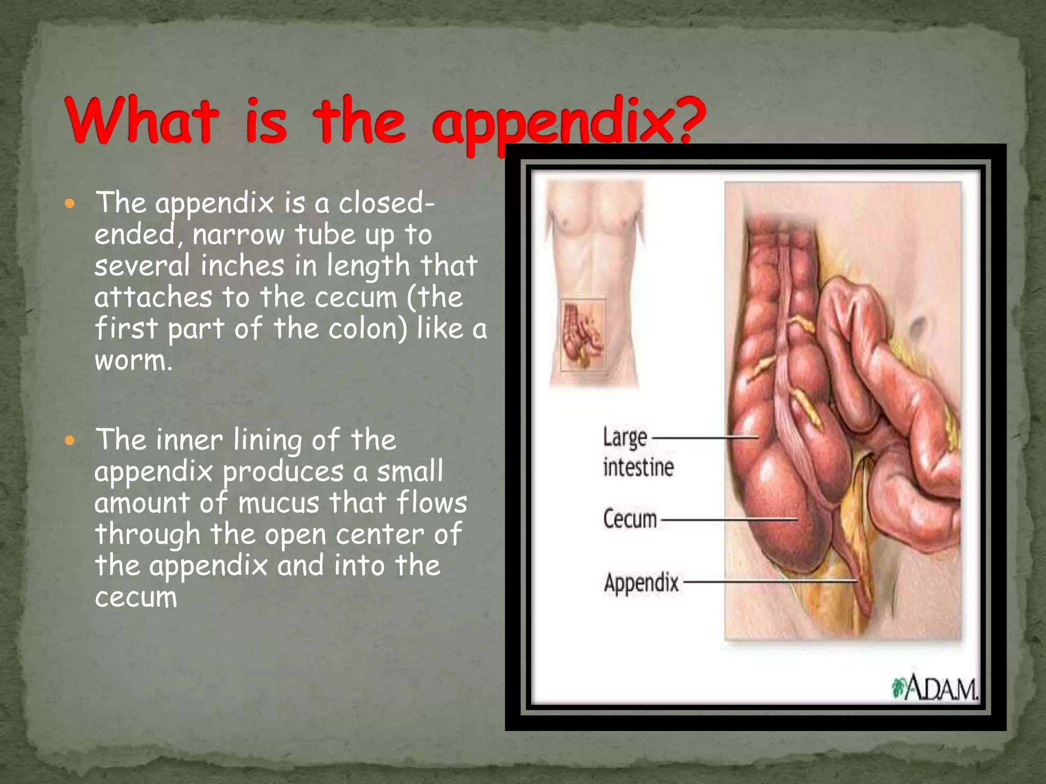 Presentation 2‏1‏ appendicitis | PPT