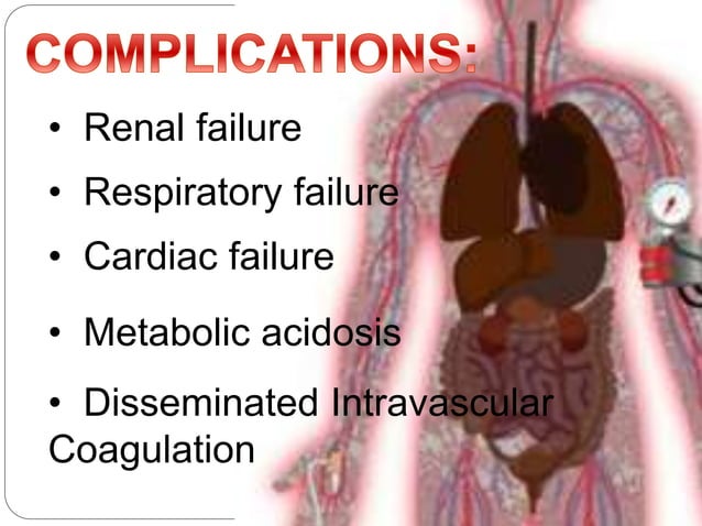 Septic shock: it occurs due to sepsis... | PPT