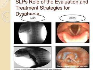 Presentation 228 denise epps neurogenic dysphagia- role of slp in ...