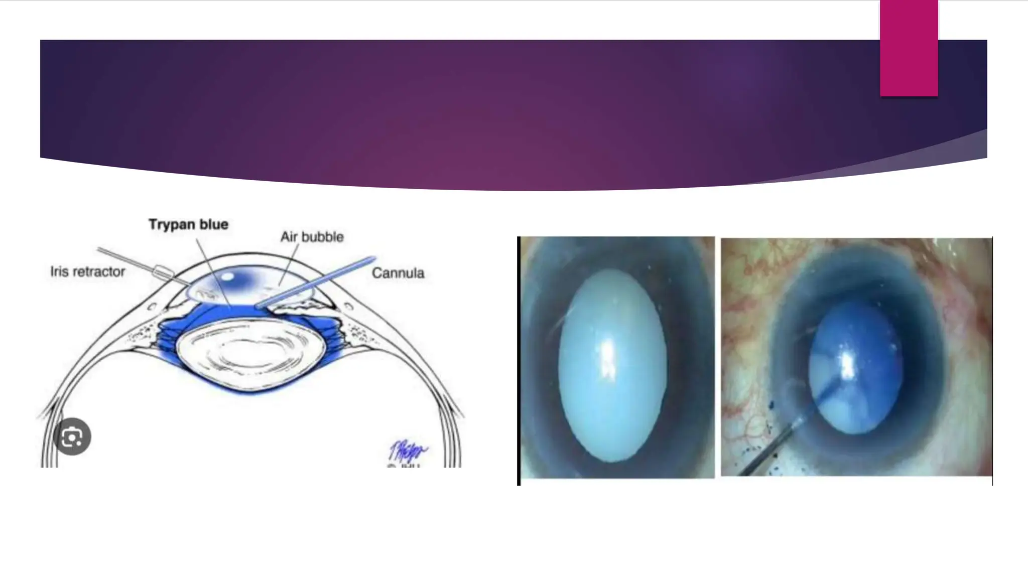 Ophthalmic Dyes.pptx