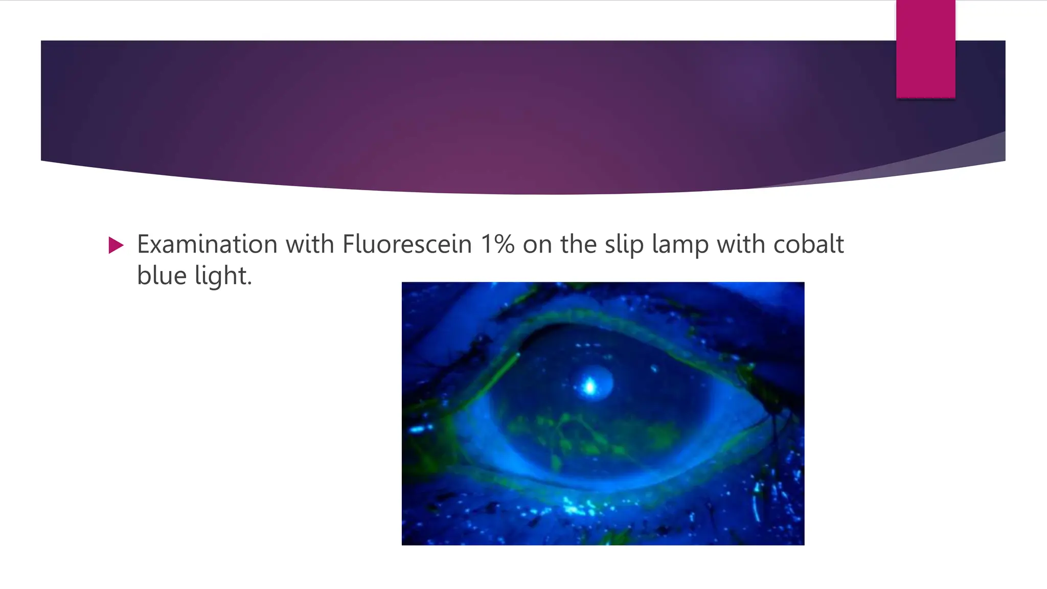 Ophthalmic Dyes.pptx