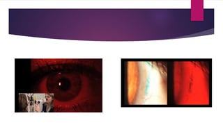 Ophthalmic Dyes.pptx