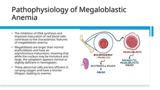 Presentation 23 megaloblastic anemia .pptx