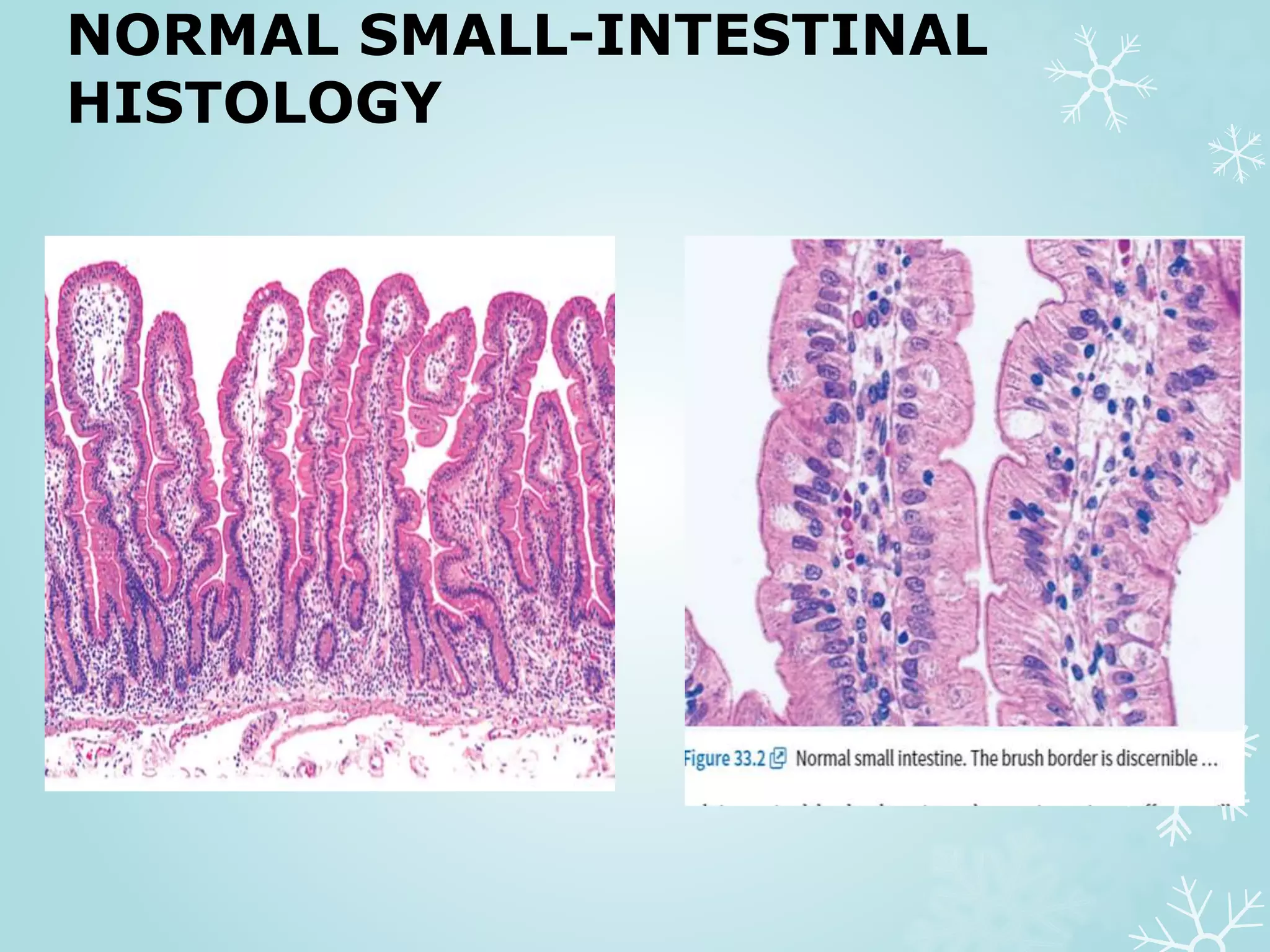 benign and malignant lesions of the intestines | PPTX