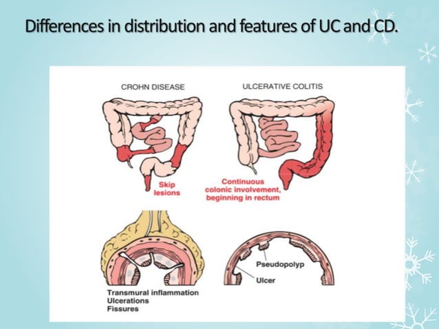 benign and malignant lesions of the intestines | PPT