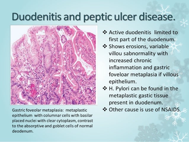 Foveolar Metaplasia Gallbladder Diet - Kiko & Miles