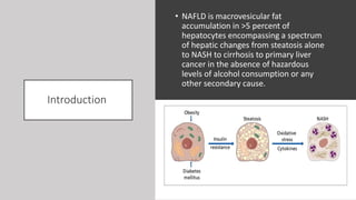 NON ALCOHOLIC FATTY LIVER DISEASE | PPTX