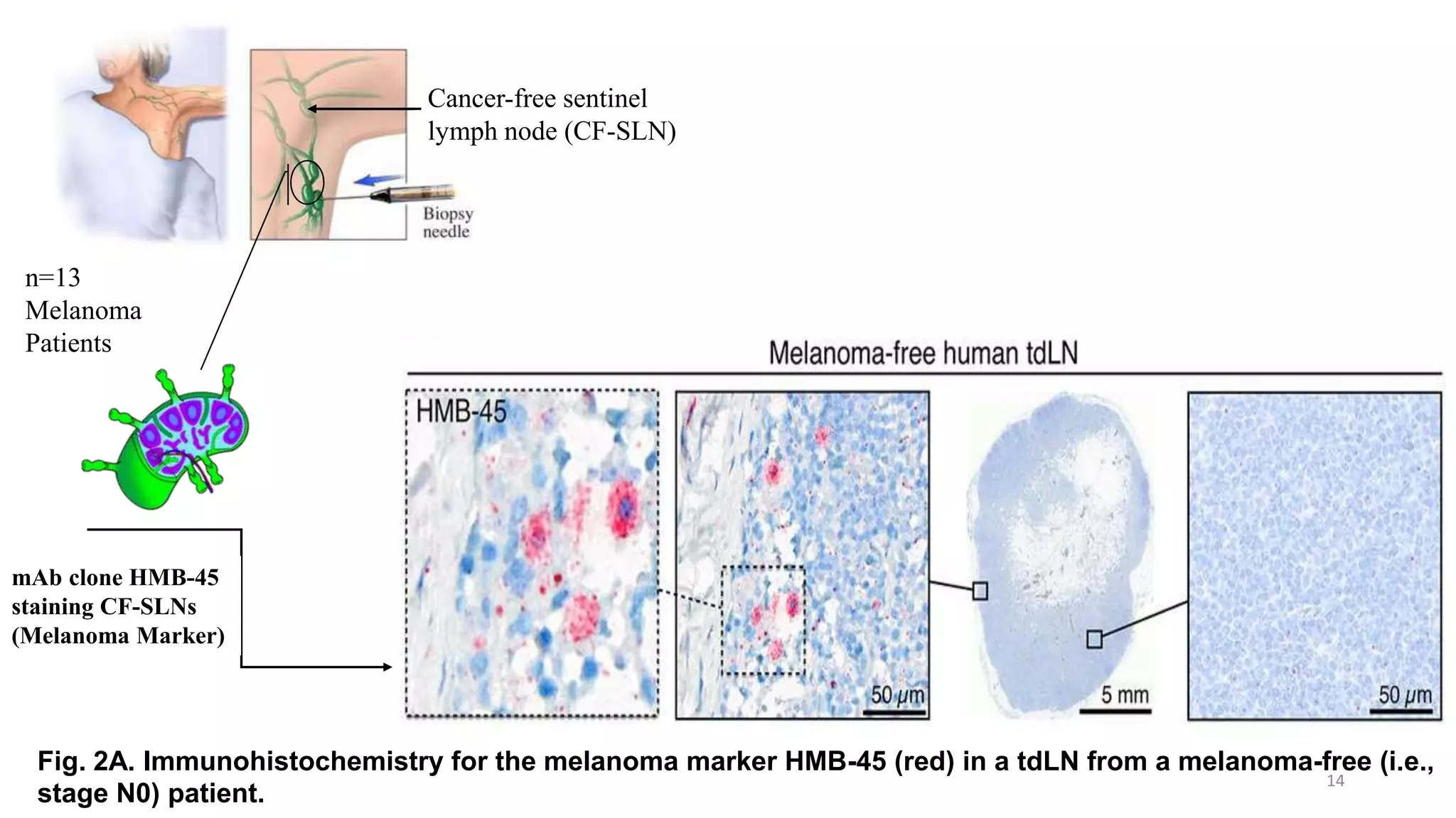 SCS macrophages suppress melanoma by restricting tumor-derived vesicle ...
