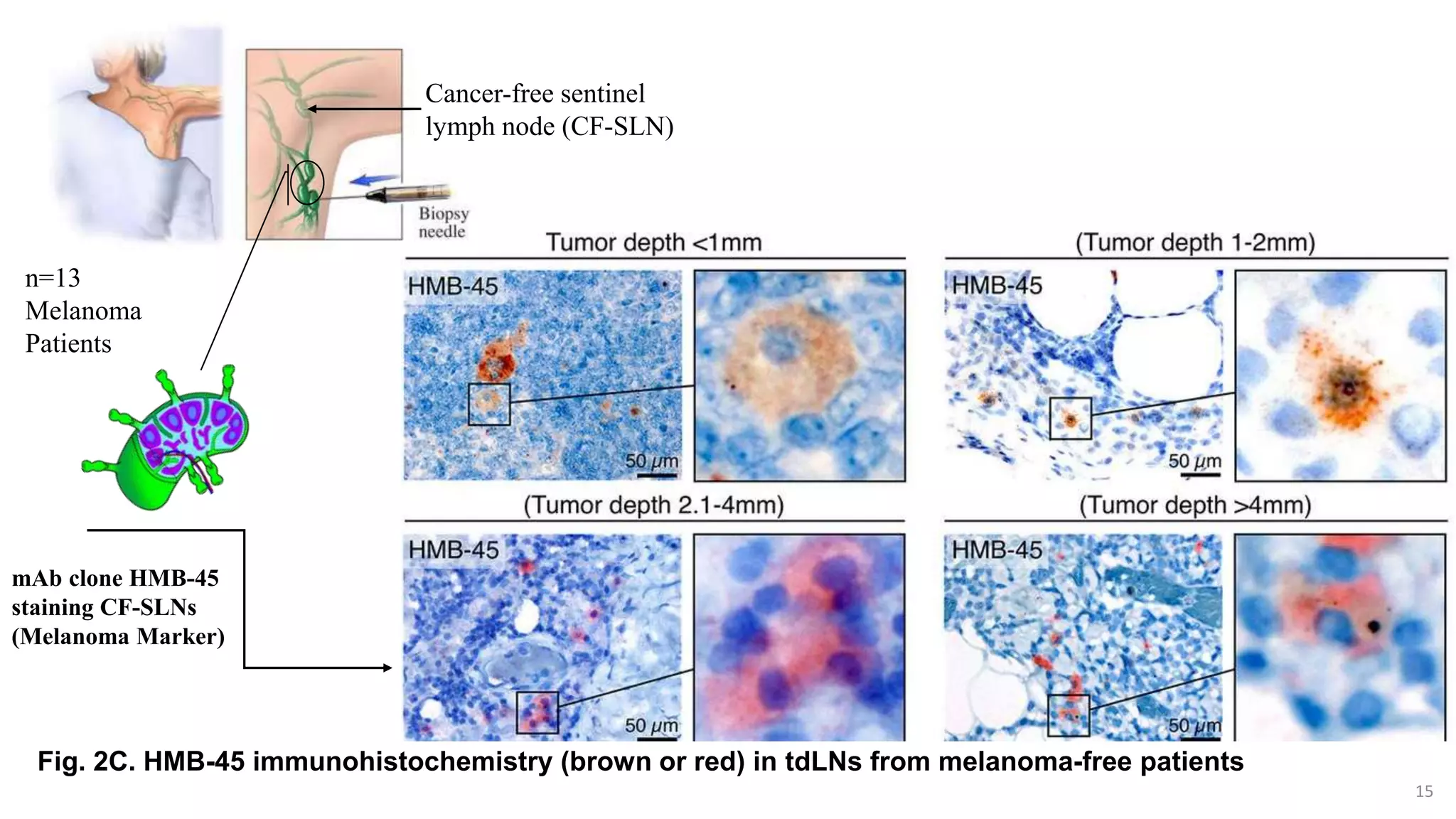 SCS macrophages suppress melanoma by restricting tumor-derived vesicle ...