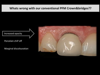 zirconia in prosthodontics. | PPTX