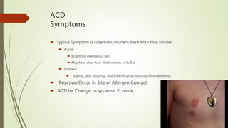 Exogenous Dermatitis | PPTX