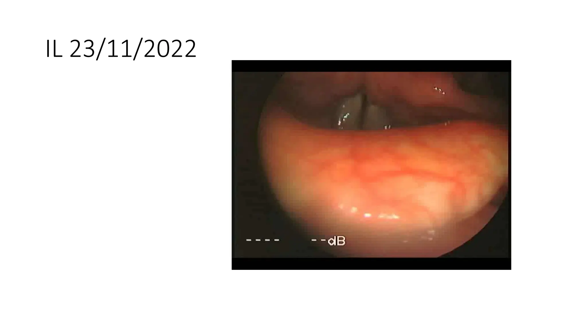 Presentation2 [Autosaved].pptx