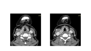 Presentation2 [Autosaved].pptx