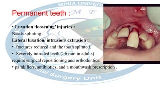 accidents and emergencies with dental fractures | PPTX