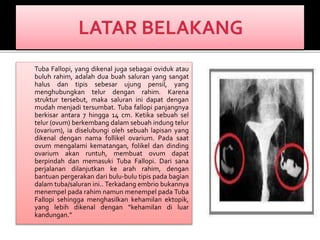 Presentation2 imser | PPTX