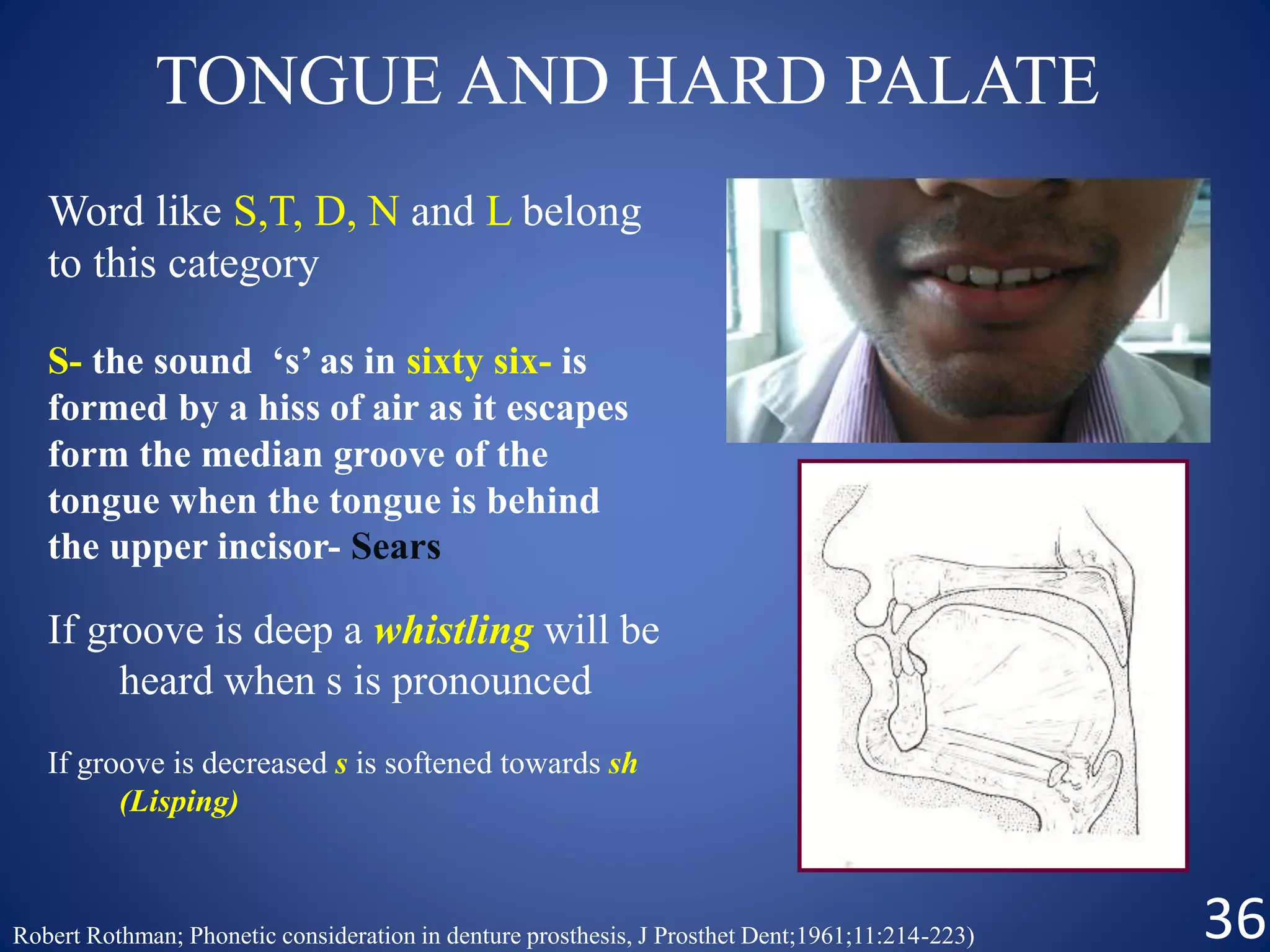 Presentation 2 phonetic in prosthodontic | PPTX