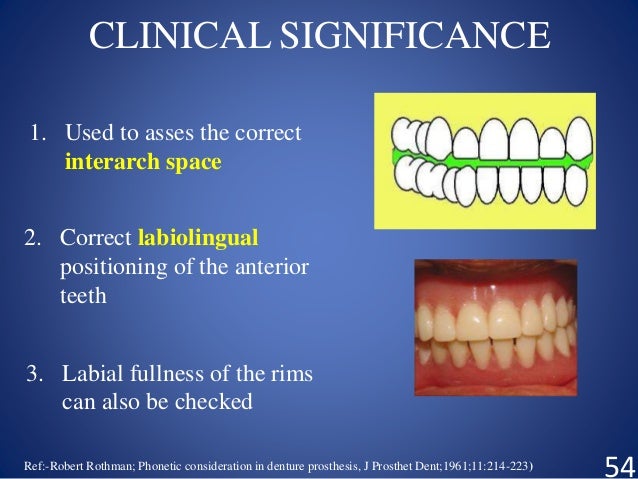 Presentation 2 phonetic in prosthodontic