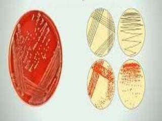 Isolation & screening of microbes.pptx