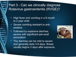 Rotavirus - Simplified Virology, Statistics, Symptoms, Vaccination ...