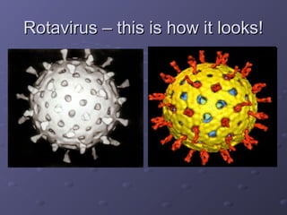 Rotavirus - Simplified Virology, Statistics, Symptoms, Vaccination ...