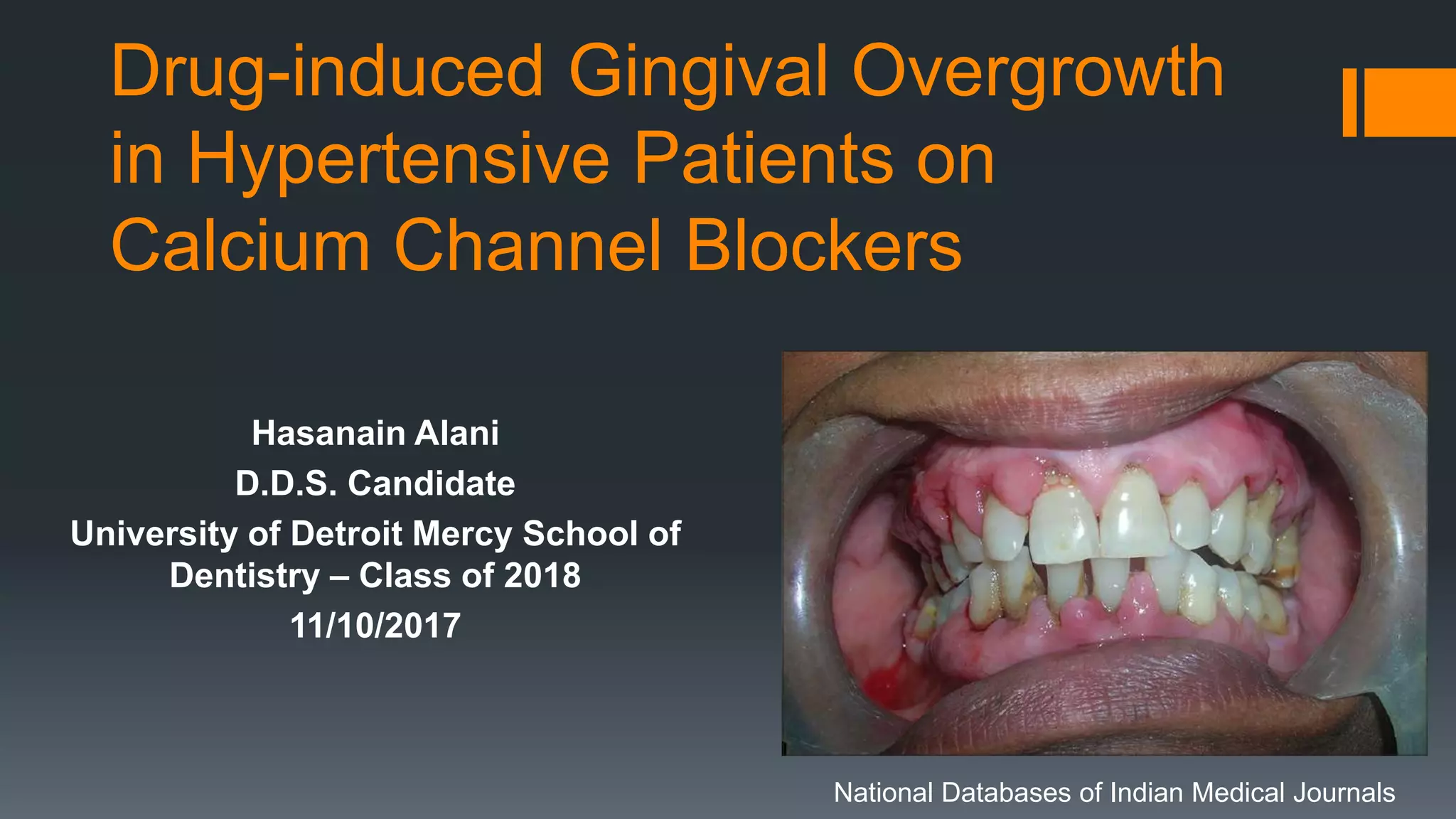 Drug-Induced Gingival Overgrowth in Hypertensive Patients on Calcium ...