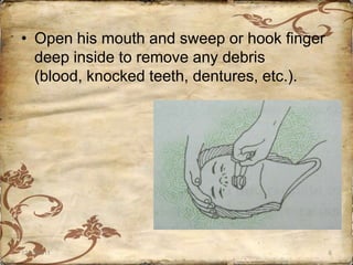 CPR - Artificial Resuscitation | PPT