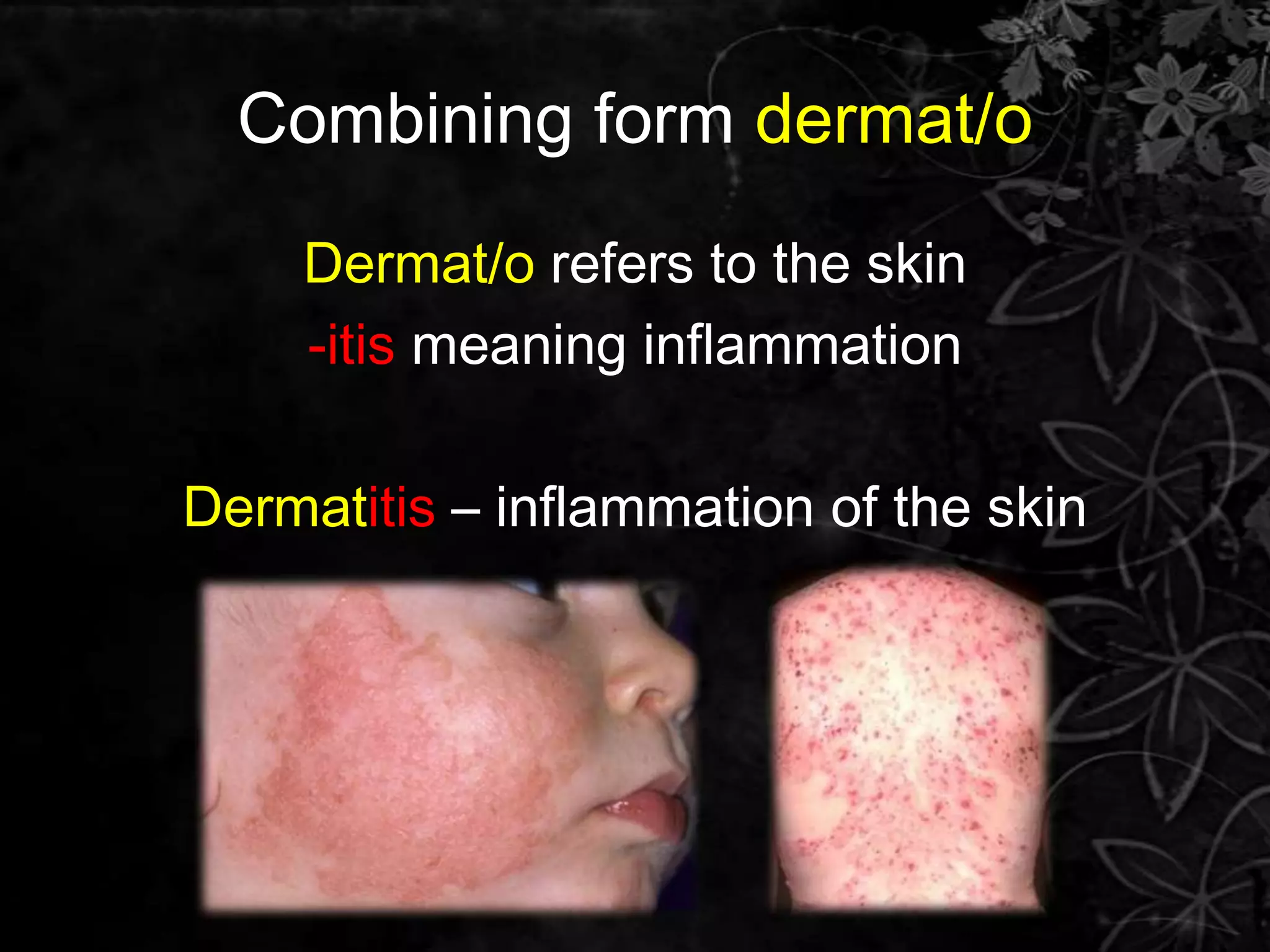 Presentation 3 | PPTX | Skin and Dermatology | Diseases and Conditions
