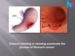 Tobacco & its effect | PPSX