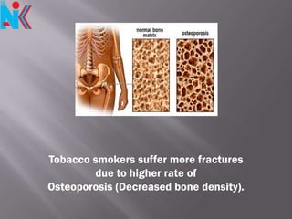 Tobacco & its effect | PPSX