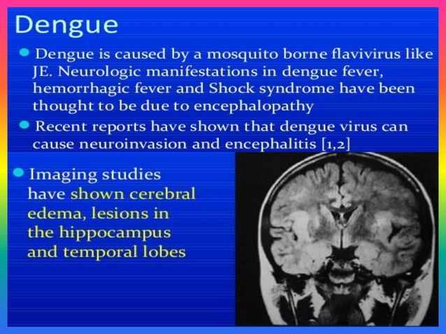 Presentation3.pptx, intra cranial infection. | PPT