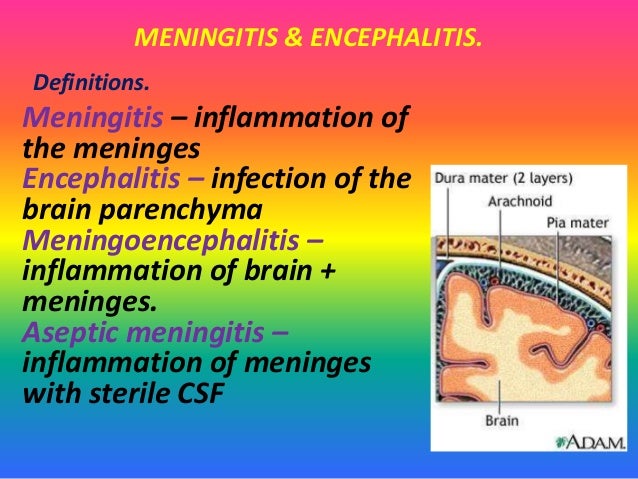 Encephalitis Causes