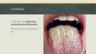 Oral Cavity is the Mirror Image of Body | PPTX