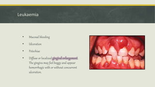 Oral Cavity is the Mirror Image of Body | PPTX