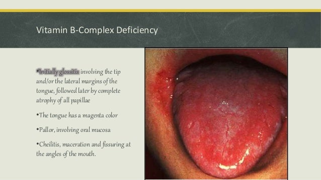 Oral Cavity is the Mirror Image of Body