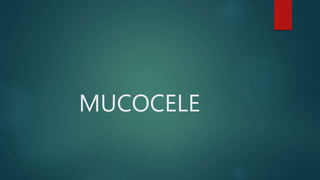 mucocele | PPTX