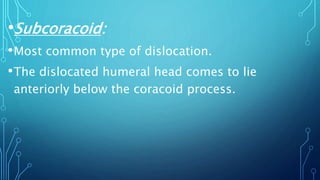 Shoulder dislocation with physiotherapy management | PPTX