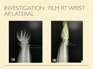 Presentation 3 | PPT