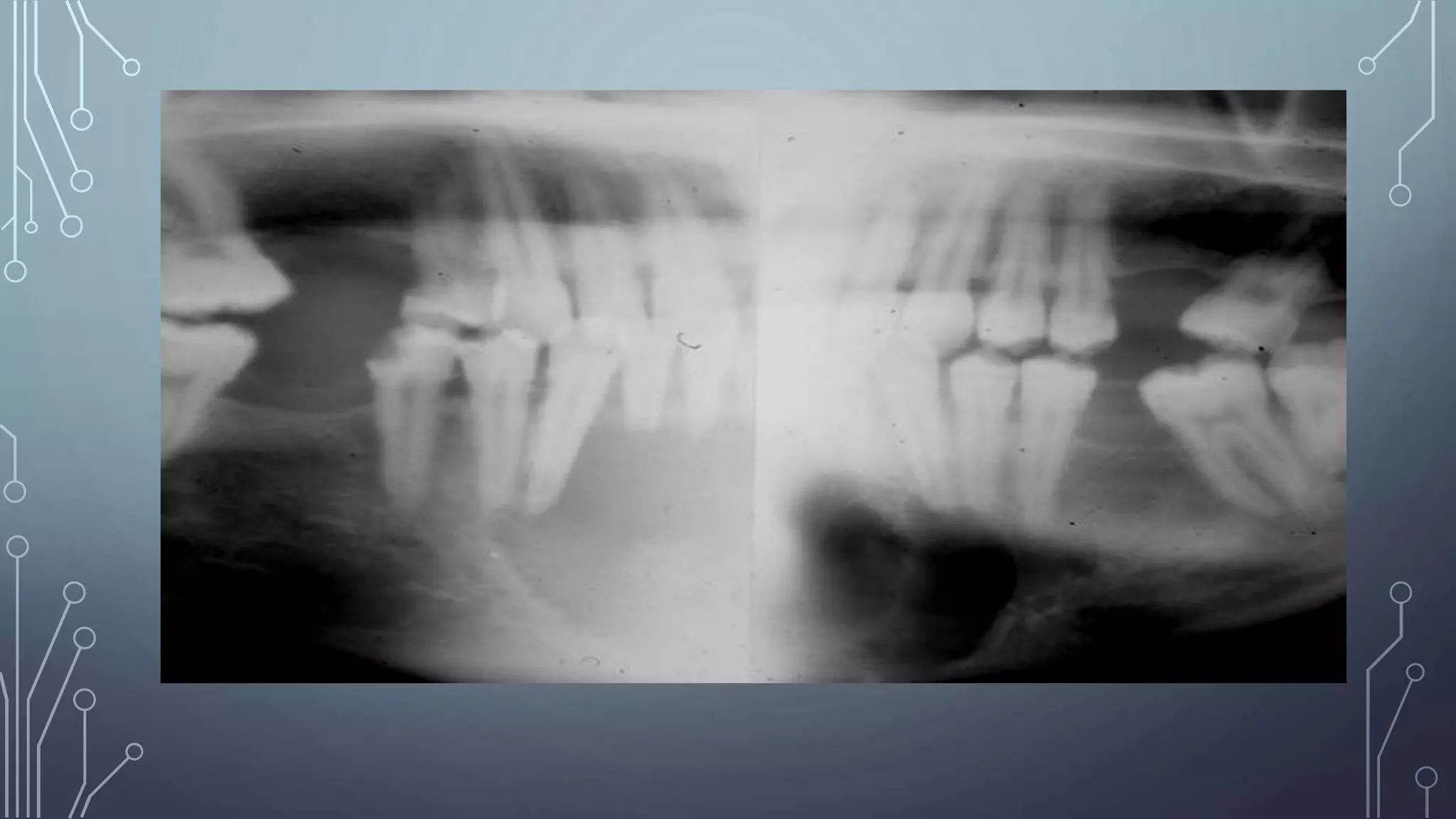 oral pathology I | PPTX